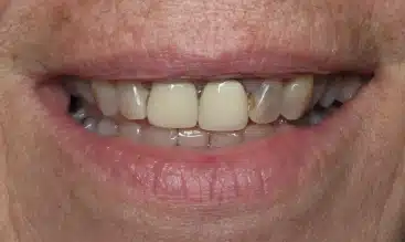 Smile Gallery Peachtree Corners, GA | Peachtree Corners Dentistry