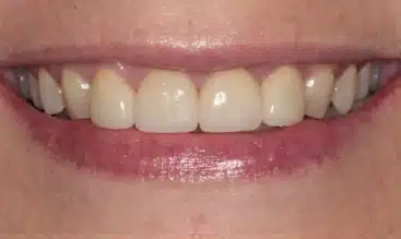 Smile Gallery Peachtree Corners, GA | Peachtree Corners Dentistry